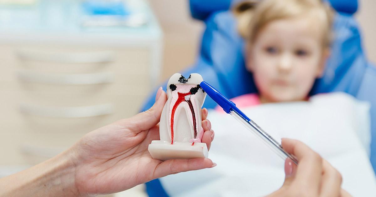 Caries dental: cómo detectarla y acabar con ella + síntomas, tipos...